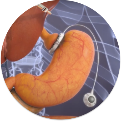 Magnetic Surgery® - Levita Magnetics