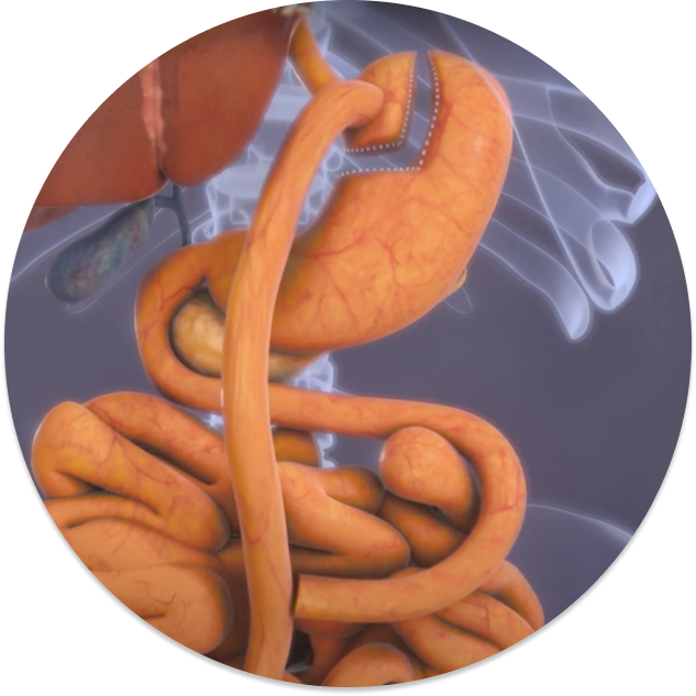 Magnetic Surgery® - Levita Magnetics