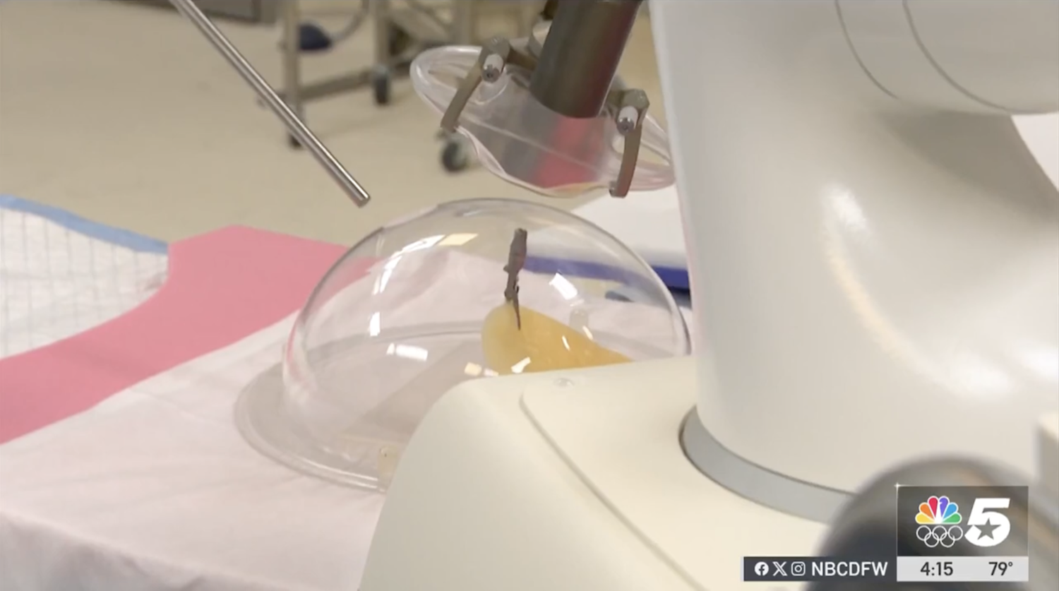 NBC 5 DFW Coverage of the First Magnetic Surgery With MARS Patient in ...